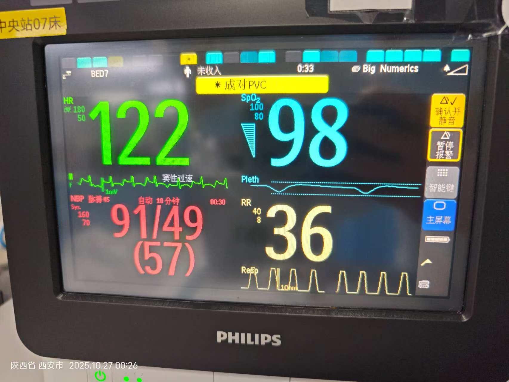 窦兜 的想法: 从交班开始就抢救 | 交完班的时候，心率和血压还能看，看病人情况不好叫我的学生抽血气的时候，血氧先掉… - 知乎
