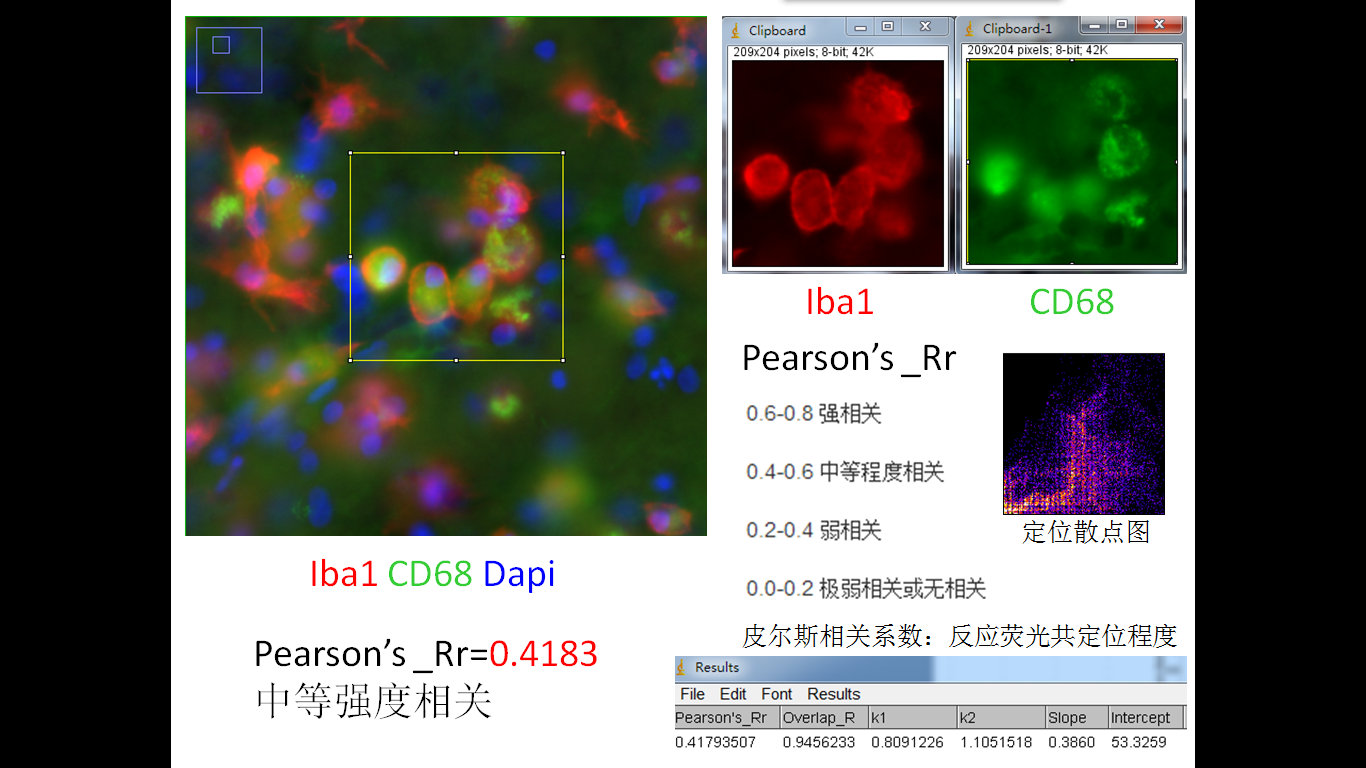 一般用imagej分析共定位用哪个插件，需要哪些参数或图来评估？ - 知乎