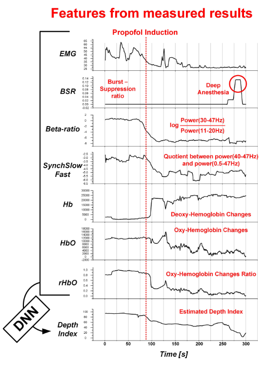 EEG,ERP,MEG,fMRI,DTI,PET,rTMS,NIRS的设备各有什么优缺点呢？ - 知乎