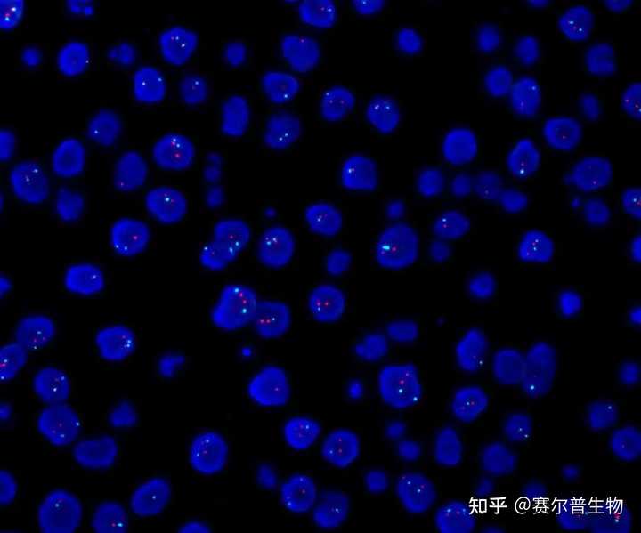 什么是荧光原位杂交（FISH）技术？ - 知乎