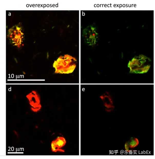 ImageJ实用技巧——荧光共定位分析(定量分析篇)？ - 知乎