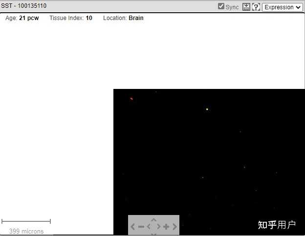关于Allen brain atlas ISH图像? - 知乎