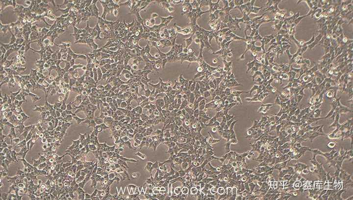 293T细胞到底该怎么养啊！? - 知乎