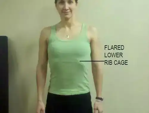 从幼年到成年一直肋骨外翻，怎么纠正？ - 知乎