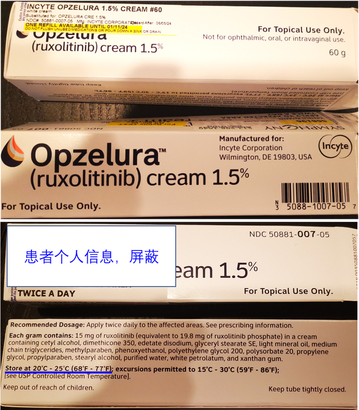 Opzelura 芦可替尼乳膏 1.5% 美国 FDA 获批上市，该药对相关患者的治疗能带来哪些帮助？ - 知乎