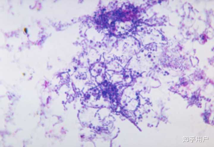想问这是什么菌的显微镜图片? - 知乎