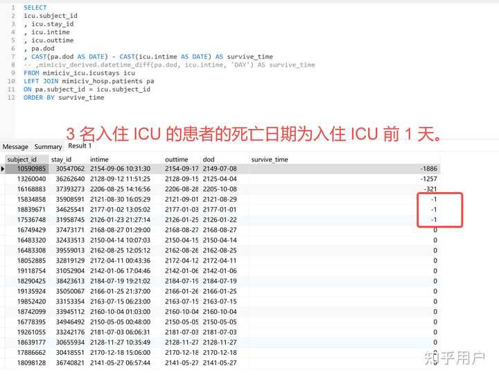 MIMIC-IV数据库， 如何提取入院患者生存时间？ - 知乎