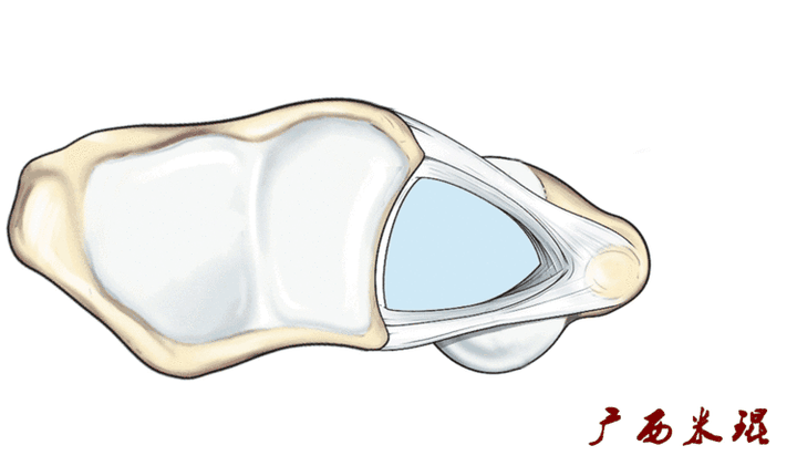 三角纤维软骨（tfcc）损伤，该如何治疗和康复呢？ - 知乎