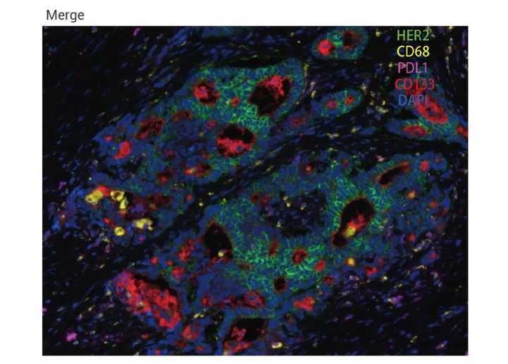 多重荧光免疫组化技术 (mIHC) 的原理什么，与 IHC 和 IF 有何区别？ - 知乎