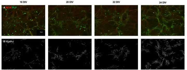有哪些实用的ImageJ使用技巧？ - 知乎