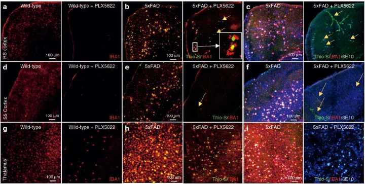 PLX5622 (CSF1R 抑制剂）如何用于小胶质细胞清除, 有啥优势？ - 知乎