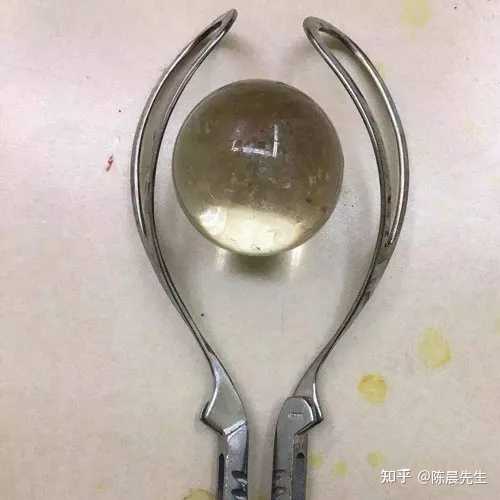 为啥新闻上总有男性肛门插入异物的新闻？ 知乎