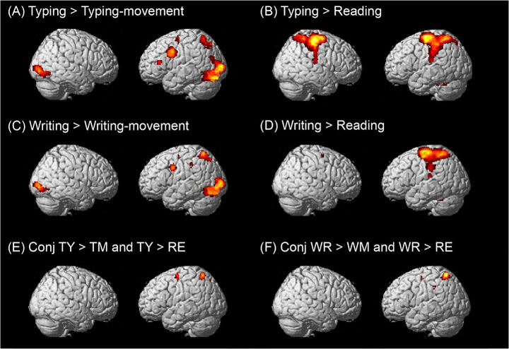 手写比键盘打字更能增强大脑连通性，这一研究具有哪些意义？ - 知乎
