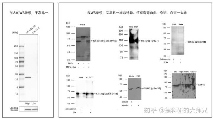为什么western blot 的条带有很多非特异性条带？有可能是一抗的原因吗？ - 知乎