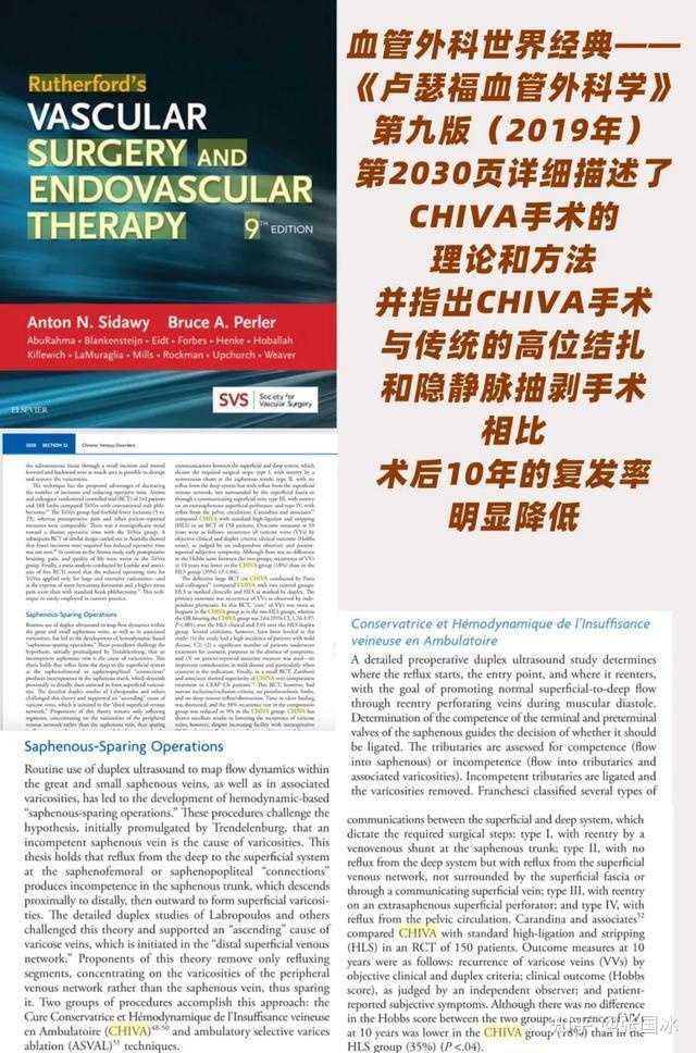 国内下肢静脉曲张CHIVA手术治疗方法成熟吗？ - 知乎