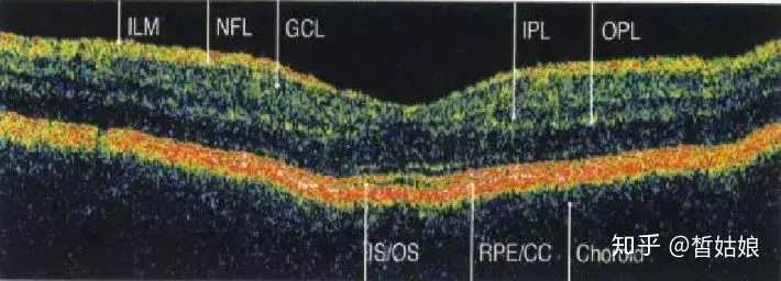 眼部oct检查怎么看？ - 知乎
