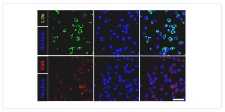 脂滴是什么，如何检测脂滴？ - 知乎