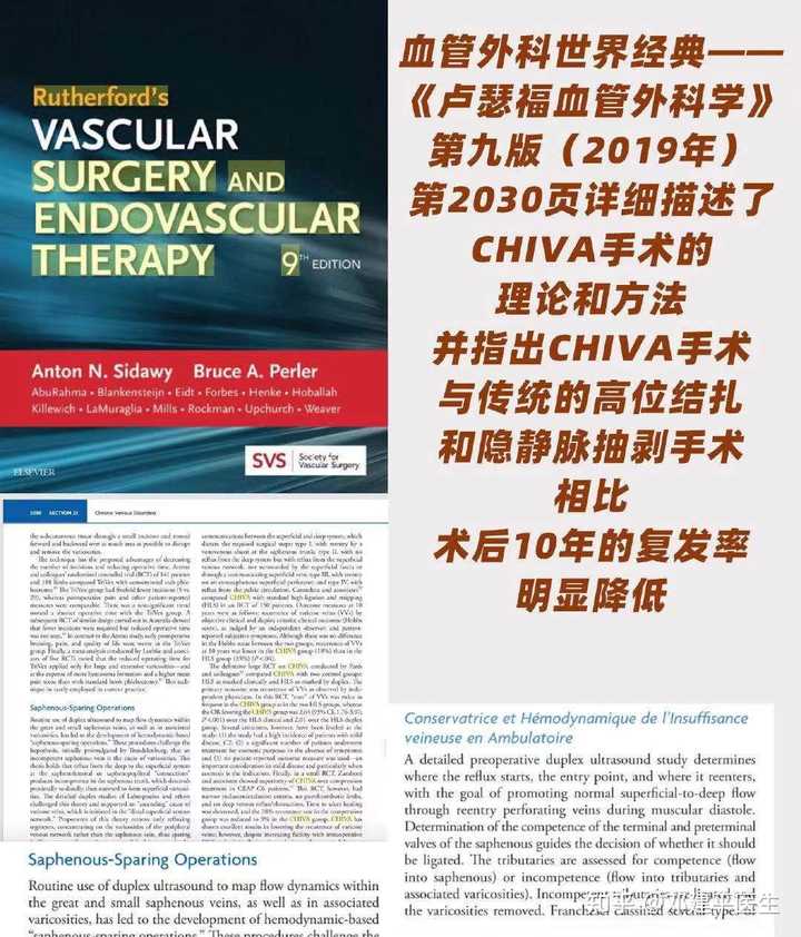 国内下肢静脉曲张CHIVA手术治疗方法成熟吗？ - 知乎