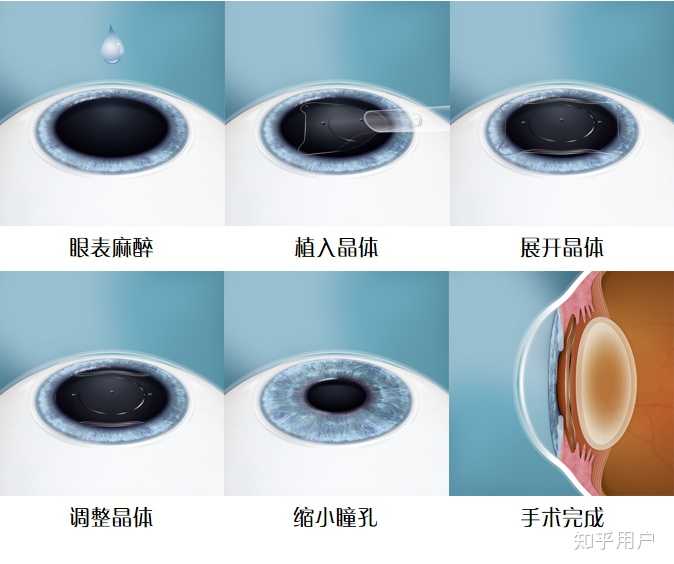 TICL与ICL有什么区别？ - 知乎