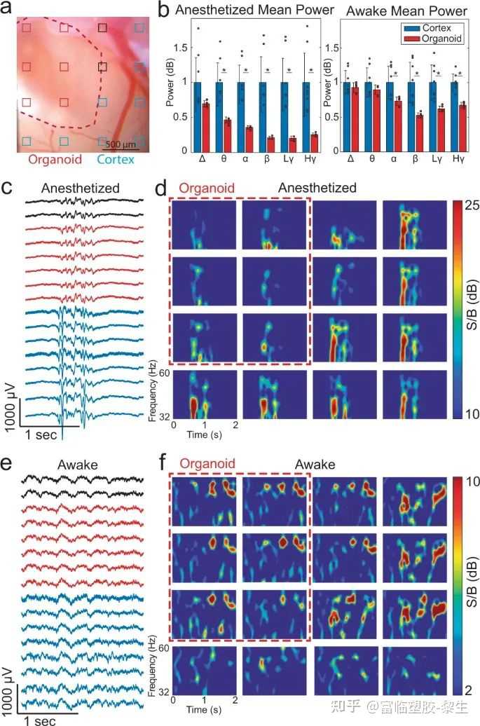 将DTA注射到cre小鼠中为什么可以敲除基因呢？ - 知乎