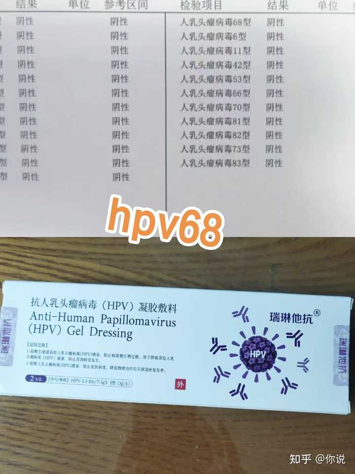 HPV68容易治愈吗? - 知乎