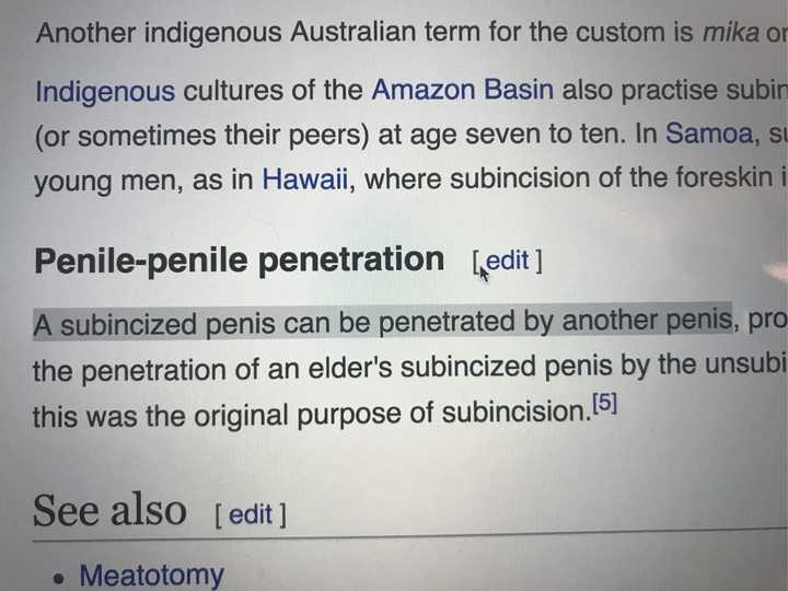 知道尿道割礼（Penile subincision）吗？ - 知乎