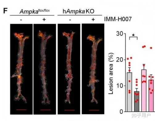 AAV PCSK9用于动脉粥样硬化疾病造模效果如何？ - 知乎