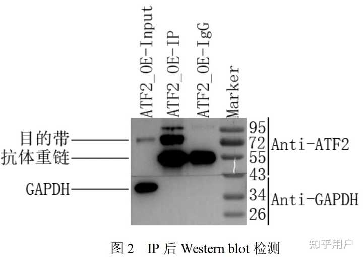 能讲解一下ChIP qPCR实验的详细步骤吗? - 知乎