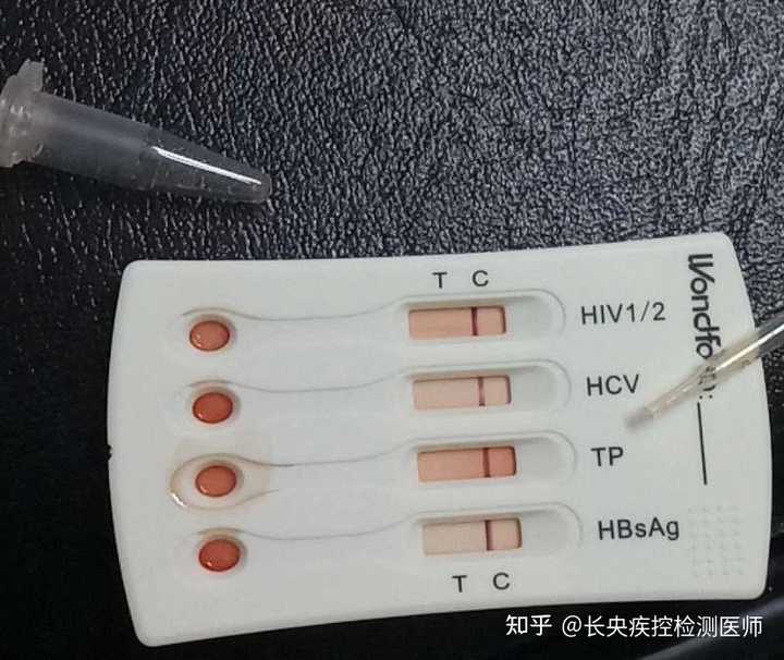hiv试纸测试准确吗?如何使用? - 知乎