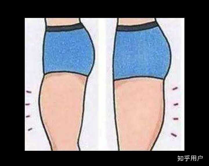 怎么消除肌肉腿？ 知乎