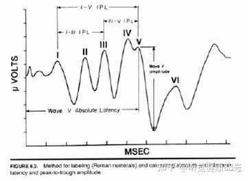 什么是ABR？ - 知乎