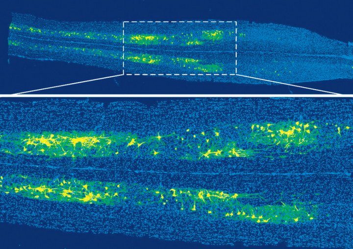 水疱性口炎病毒（VSV）作为病毒载体的优点有哪些？ - 知乎