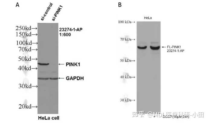 线粒体自噬的机制及检测方法是什么？ - 知乎