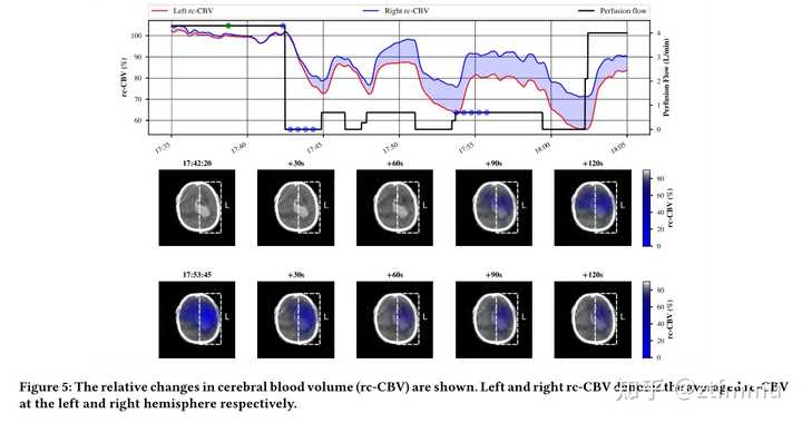 对于电阻抗成像技术（EIT）在世界上研究进展如何？ - 知乎