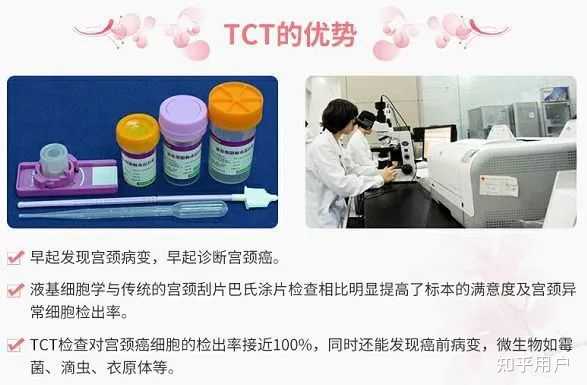 TCT和HPV检查都是什么，有什么区别呢？ - 知乎