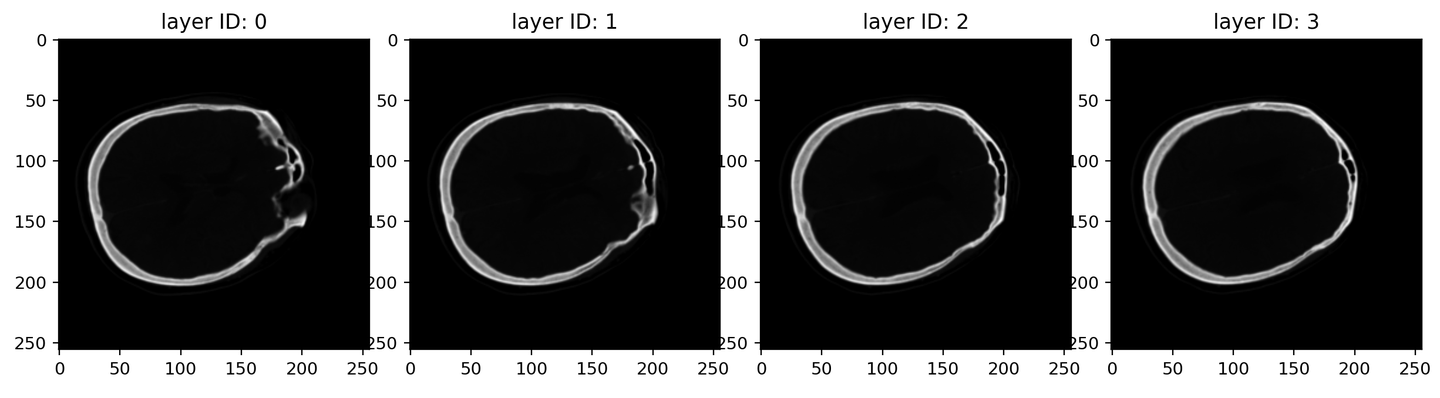 python 与 JavaScript 读取并可视化 CT 图像 (.nii & .nii.gz)