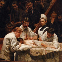 AJCC与JGCA对胃癌区域淋巴结定义的差异 - 知乎