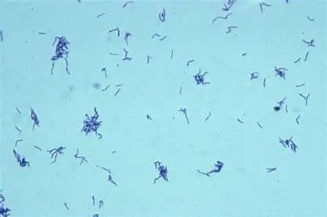 肠杆菌科多样化菌属——Eubacterium（真/优杆菌属） - 知乎