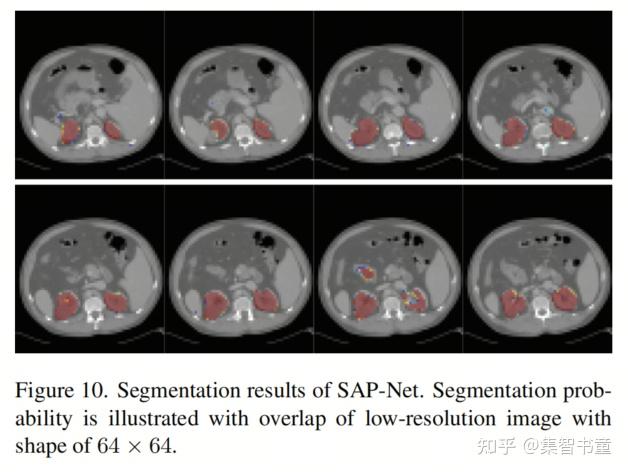 SAM-Med | 英伟达基于SAM提出医学图像标注效率神器 - 知乎