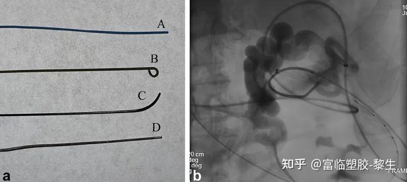 了解介入放射学中常用导丝的基础知识 - 知乎