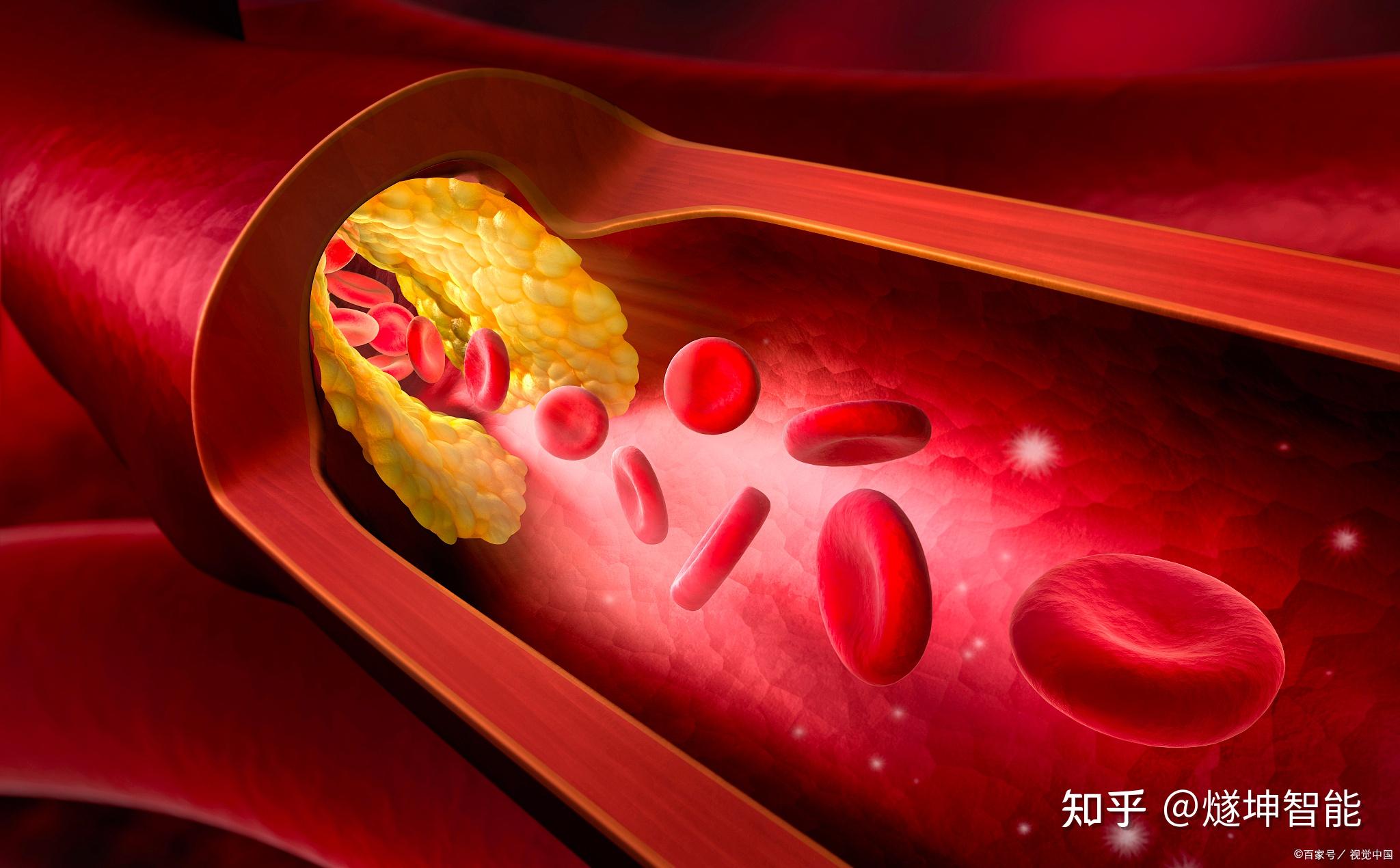 胆固醇守护神：探秘PCSK9蛋白，心血管健康的钥匙 - 知乎