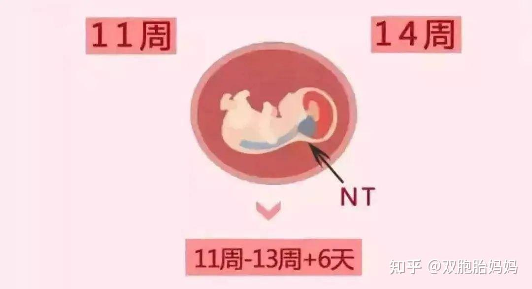 掌握基本功！一看就懂的NT测量常用解读方法，图文并茂 - 知乎