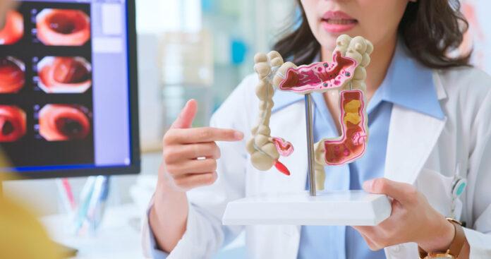 Cancer Sci | 探索结直肠癌的突变图谱 - 知乎