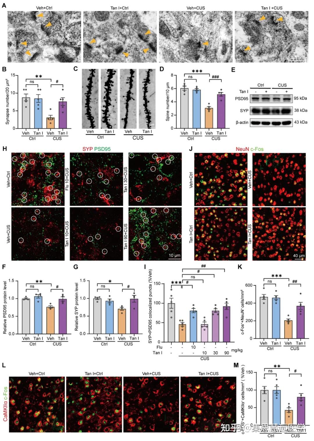 IF13+!解密抑郁症药物研发新机制：DARTS-MS+MST/CETSA/分子动力学模拟揭示丹参酮I靶向补体C3发挥抗抑郁功能 - 知乎