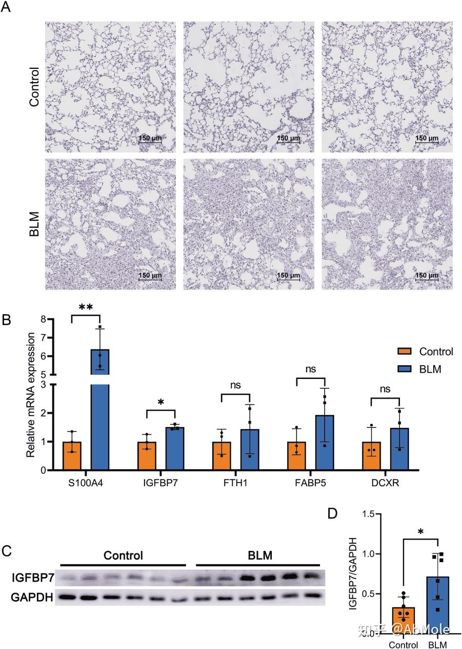 AbMole小课堂丨Bleomycin (BLM) : 博来霉素——构建肺纤维化，系统性硬化症等多种模型的科研工具 - 知乎