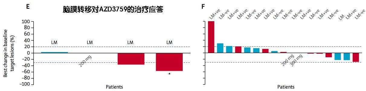 肺癌入脑靶向药物AZD3759一期临床试验疗效显著 - 知乎
