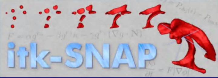 医学图像2D/3D可视化 ITK-SNAP软件使用 - 知乎