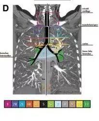 重要图文：纵隔淋巴结的分区（IASLC） - 知乎