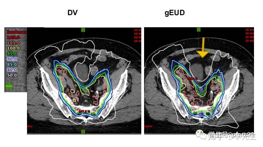 学习gEUD，用好gEUD（第二篇）。 - 知乎