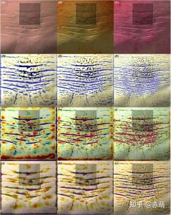 技术解读|Antera 3D：一款使用皮肤3D成像技术的手持式便携照相机 - 知乎